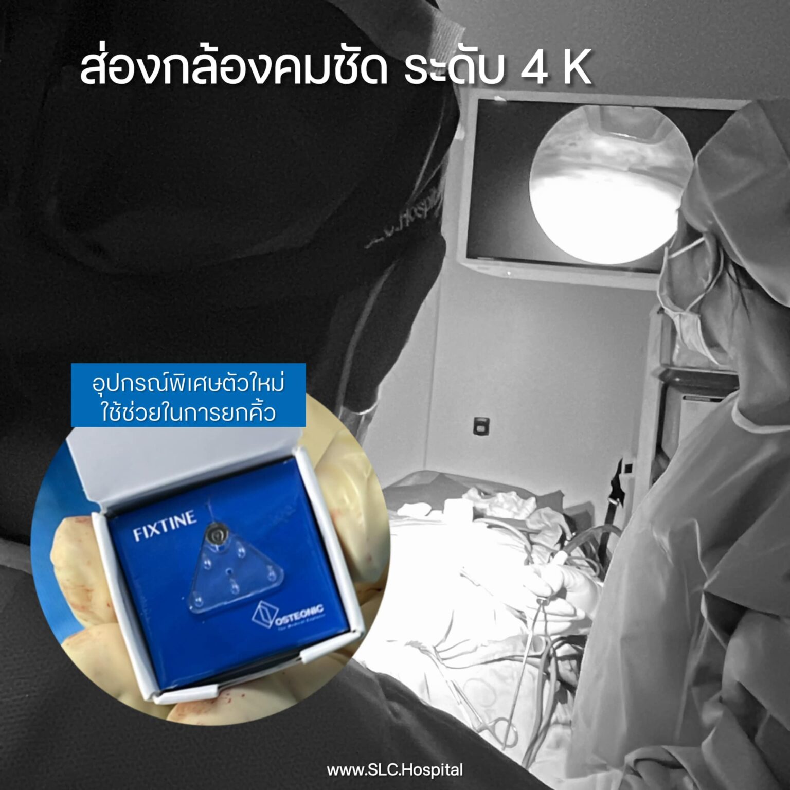 ความลับหน้าแบ๊ว ยกคิ้ว EndoFix™ เทคนิคใหม่ล่าสุดที่สายเกาต้องรู้