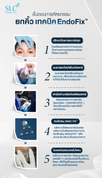 ความลับหน้าแบ๊ว ยกคิ้ว EndoFix™ เทคนิคใหม่ล่าสุดที่สายเกาต้องรู้