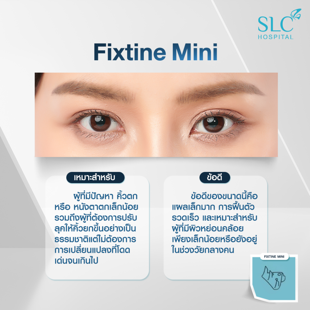 ความลับหน้าแบ๊ว ยกคิ้ว EndoFix™ เทคนิคใหม่ล่าสุดที่สายเกาต้องรู้