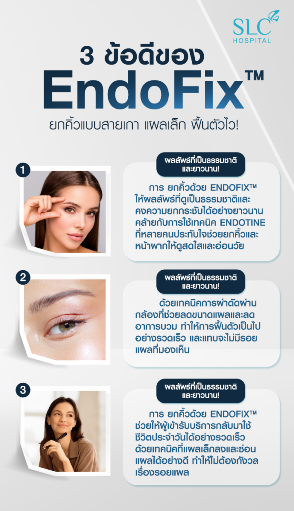 ความลับหน้าแบ๊ว ยกคิ้ว EndoFix™ เทคนิคใหม่ล่าสุดที่สายเกาต้องรู้