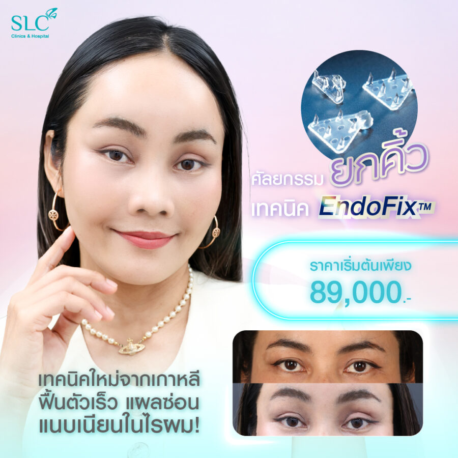 เปิดโลกการยกคิ้ว สวยครบทุกมุม ด้วย 3 เทคนิคและโปรดีต่อใจ! - SLC Hospital